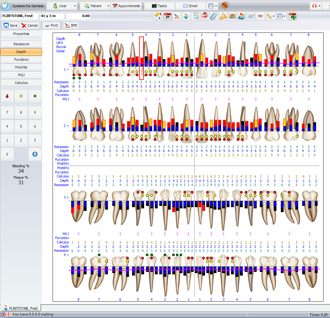 Dental Software Perio Examination
